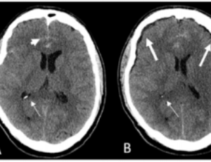 Journal of Neurology and Translational Neuroscience
