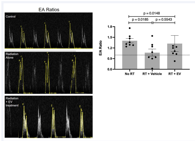 Assessment of Cardiotoxicity in Mice Following Thoracic Radiotherapy ...