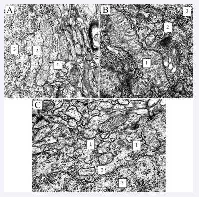 Comparative Characteristics of the Ultrastructure of the Pyramidal ...