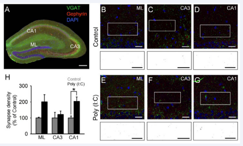 Severity of Kainic Acid-Induced Seizures is not Aggravated in the ...