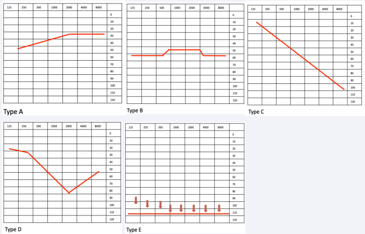 Sudden Hearing Loss: When Is Hyperbaric Oxygen Indicated