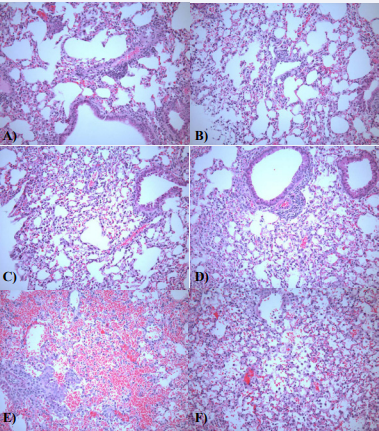 Prophylactic and Therapeutic and Adjuvant Properties of Intranasal the ...