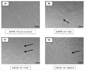 Novel Immune Regulatory Pathway Associated with Epstein Barr Virus and ...