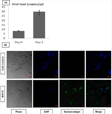 Novel Immune Regulatory Pathway Associated with Epstein Barr Virus and ...