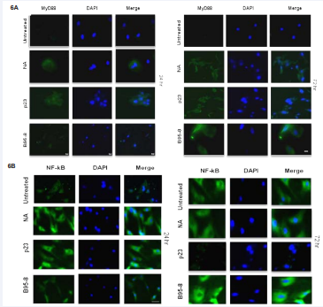 Novel Immune Regulatory Pathway Associated with Epstein Barr Virus and ...