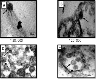 Novel Immune Regulatory Pathway Associated with Epstein Barr Virus and ...