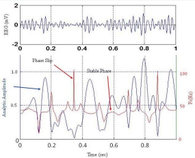 Increased Phase Clustering in Epileptogenic Areas Measured with 256 ...