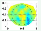 Increased Phase Clustering in Epileptogenic Areas Measured with 256 ...