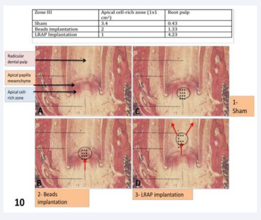The Dental Pulp: Composition, Properties and Functions