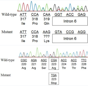 Novel De Novo Mutations in Pax3 Gene Causing Hearing Loss in ...